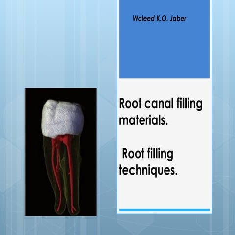 5 root canal filling materials | PPT