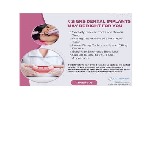 5 Signs Dental Implants May Be Right For You | DOCX | Dental Health ...