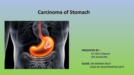 Blood supply and lymphatic drainage of stomach | PPTX