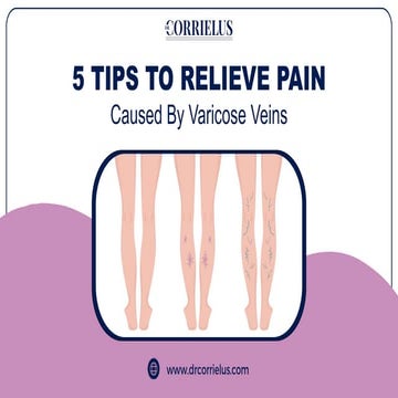 5 TIPS TO RELIEVE PAIN | PPT