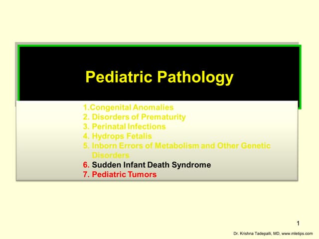 Sudden infant death syndrome | PPTX