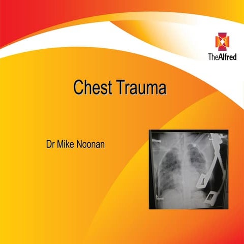 Chest Trauma - Mike Noonan | PPT