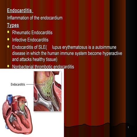 6.Infective endocarditis pathology | PPT