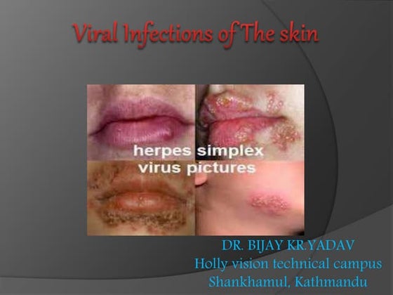 viral derm.pptx | Skin and Dermatology | Diseases and Conditions