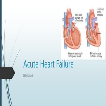 Acute heart failure | PPT