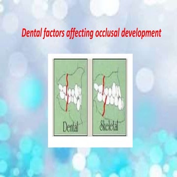 6.Dental factors affecting occlusal development .pptx | Dental Health ...