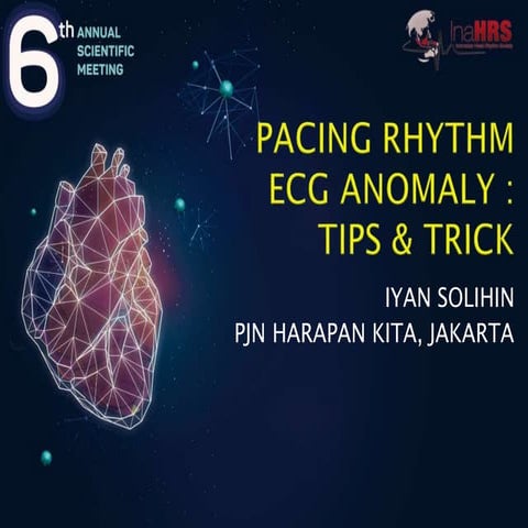 6. Tips and Trick PACING RHYTHM.pdf