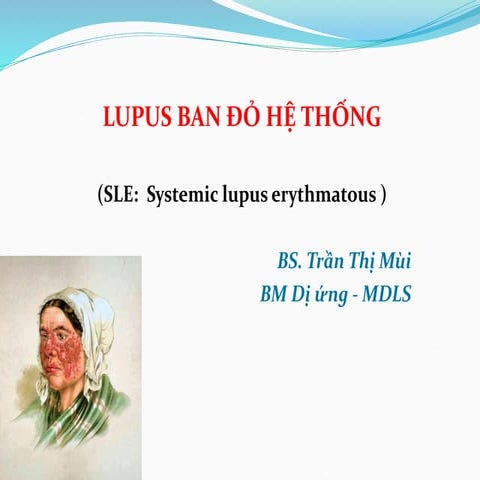 6. Lupus ban đỏ hệ thống (SLE).pdf hay cực kỳ | PDF