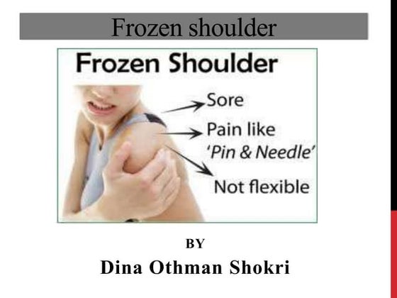 Frozen shoulder | PPTX | Physical Therapy | Wellness