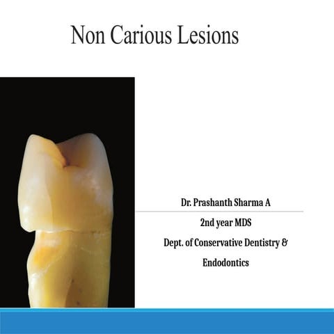Non carious lesions of teeth and their management.pptx