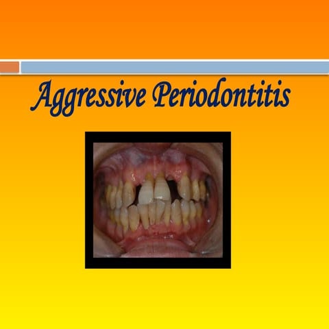 Aggressive Periodontitis | PPTX