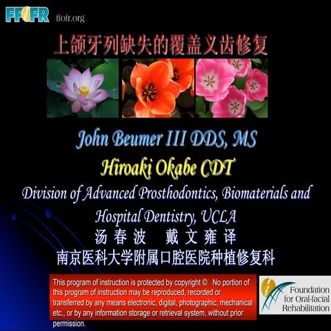 译6.edent max overlay dentures | PPT