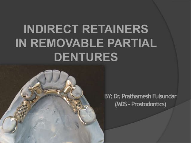 Direct & indirect retainers in rpd