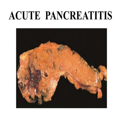 Management of Acute Pancreatitis | PPTX | Digestive Disorders ...
