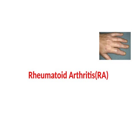 Rheumatoid arthritis ,definition,pathophysiology | PPTX