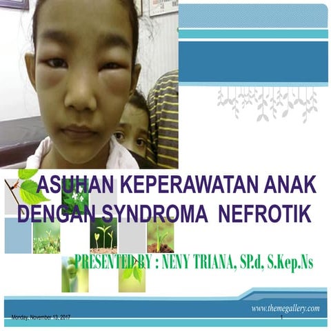 ASUHAN KEPERAWATAN ANAK DENGAN SYNDROMA NEFROTIK | PPT