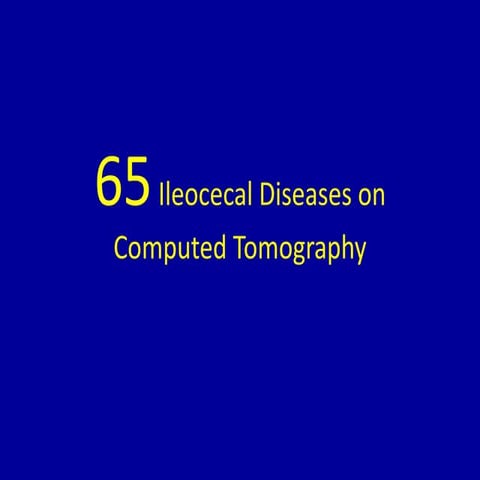 65 ileocecal diseases on computed tomography | PPTX