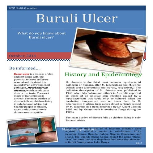 buruli ulcer | DOCX