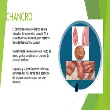 desarrollo de chancro transmitido en piel de humano | PPTX