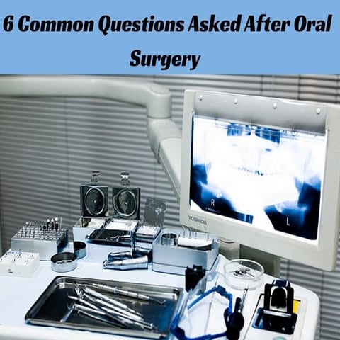 6 Common Questions Asked After Oral Surgery | PDF