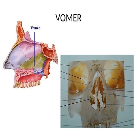VOMER................................... | PPT