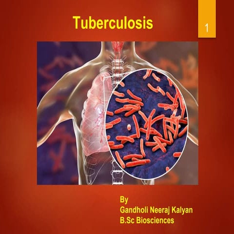 Tuberculosis and it's treatment | PPT