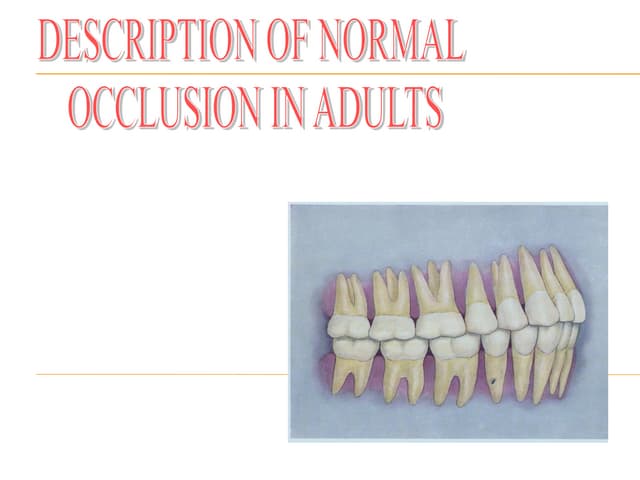 Andrew’s six keys of normal occlusion | PPTX