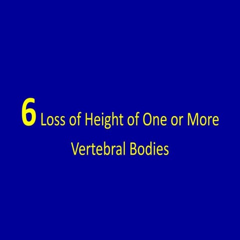 6 loss of height of one or more | PPTX