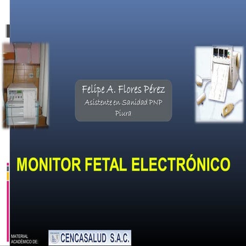 6° Monitor Electronico Fetal | PPT
