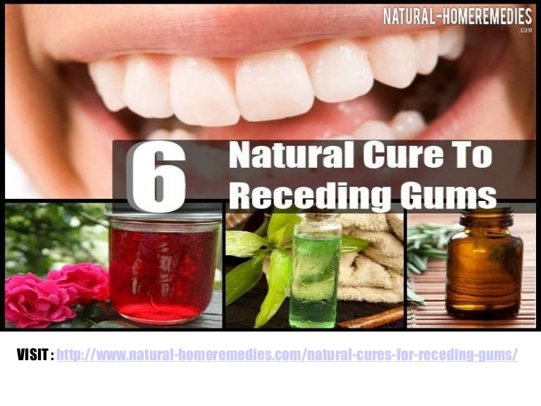6 Natural Cures For Receding Gums