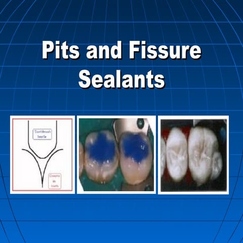 hydrocolloids impression dental material | PPT