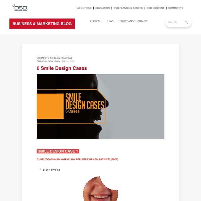 Digital Smile Designing | PPTX