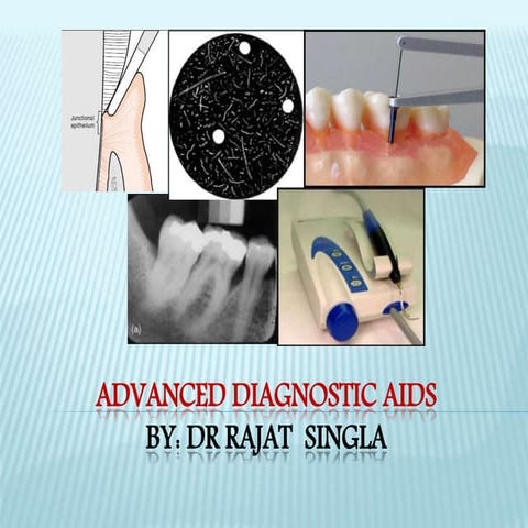 ADVANCE DIAGNOSTIC AIDS | PPT