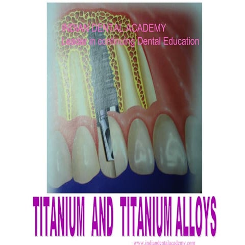 7.titanium and titanium alloys /orthodontic courses by Indian dental ...