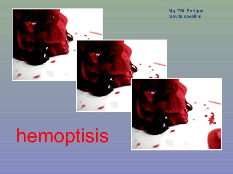 HEMOPTISIS