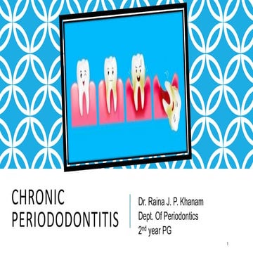 Chronic periodontitis | PPTX