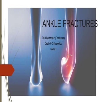 Ankle fractures | PPTX