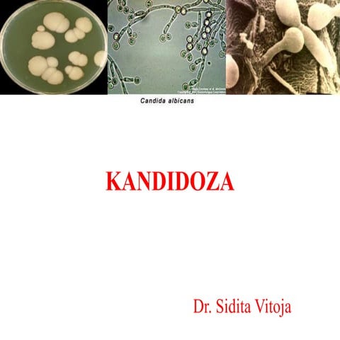 7. KANDIDOZA.pptx