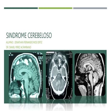 7.-SINDROME CEREBELOSO.pptx