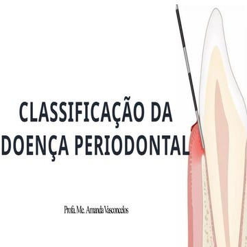CLASSIFICAÇÃO DA DOENÇA PERIODONTAL.PPTX