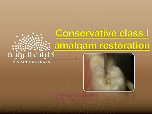 Class II Amalgam Preparation | PPT
