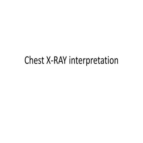 Chest xray interpretation made easy basics | PPT