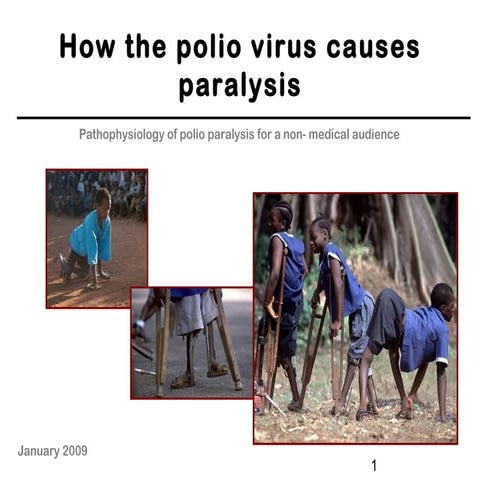 Polio pathophysiology | PPS