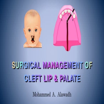 Management of Cleft Lip and Cleft Palate | PDF
