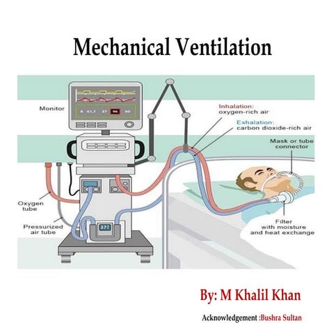 7 Mechanical Ventilation.pptx its very easy | PPTX