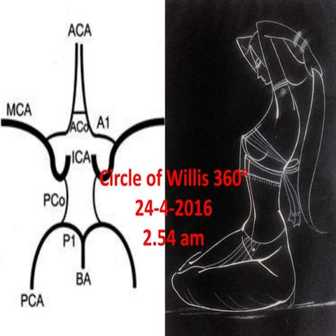 Circle of willis 360° | PPTX