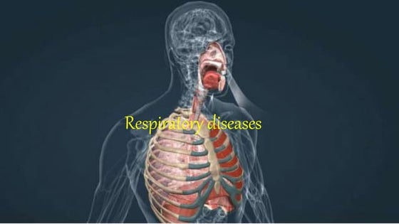 Upper Respiratory Tract Infections Pptx6666 Ppt