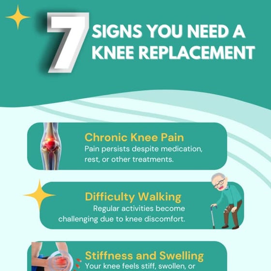 Myths vs Facts – Joint Replacement Surgery | PDF