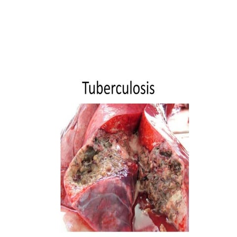 7_TUBERCULOSIS_(2).pptx