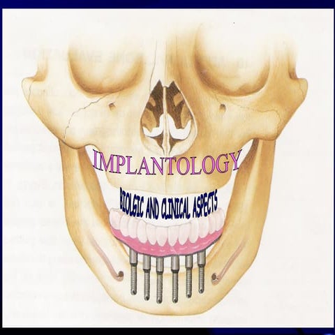 implantology biologic and clinical aspects / dental implant courses by ...